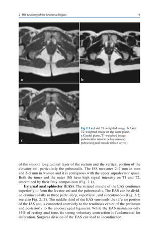 Imaging of perianal inflammatory diseases | PDF