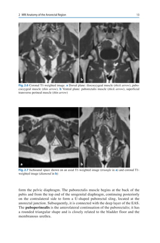 Imaging of perianal inflammatory diseases | PDF