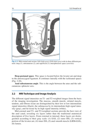 Imaging of perianal inflammatory diseases | PDF