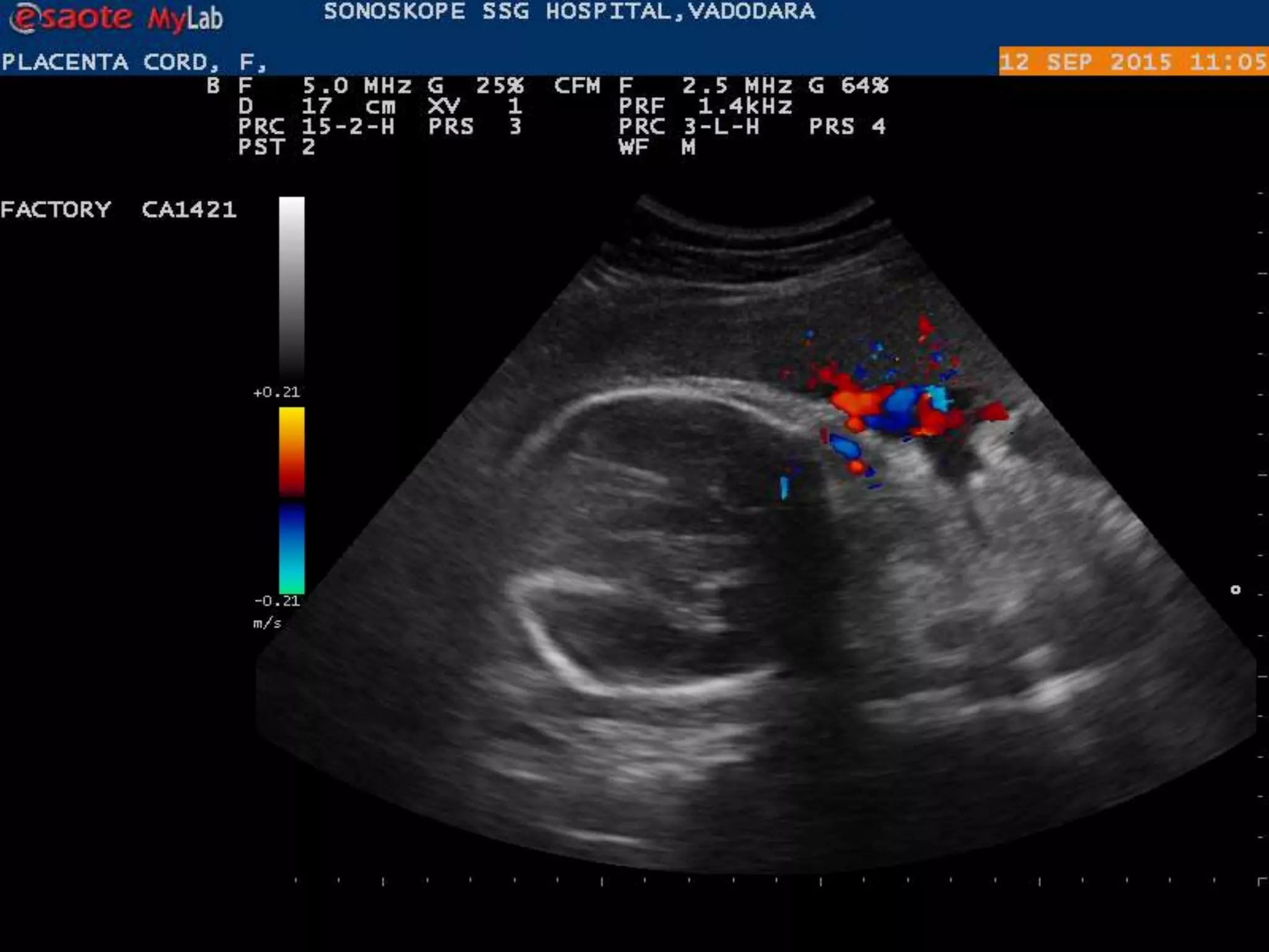 Imaging of placenta | PPTX