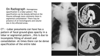 Imaging of pulmonary infections | PPTX