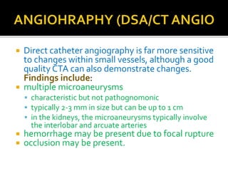 Imaging of renal hypertension | PPTX