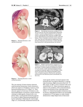 Imaging of Renal Trauma A Comprehensive Review.pdf