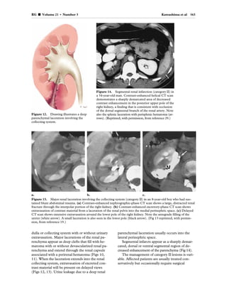 Imaging of Renal Trauma A Comprehensive Review.pdf