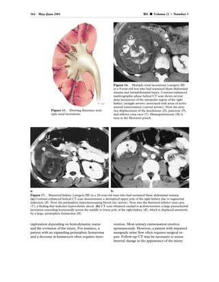 Imaging of Renal Trauma A Comprehensive Review.pdf