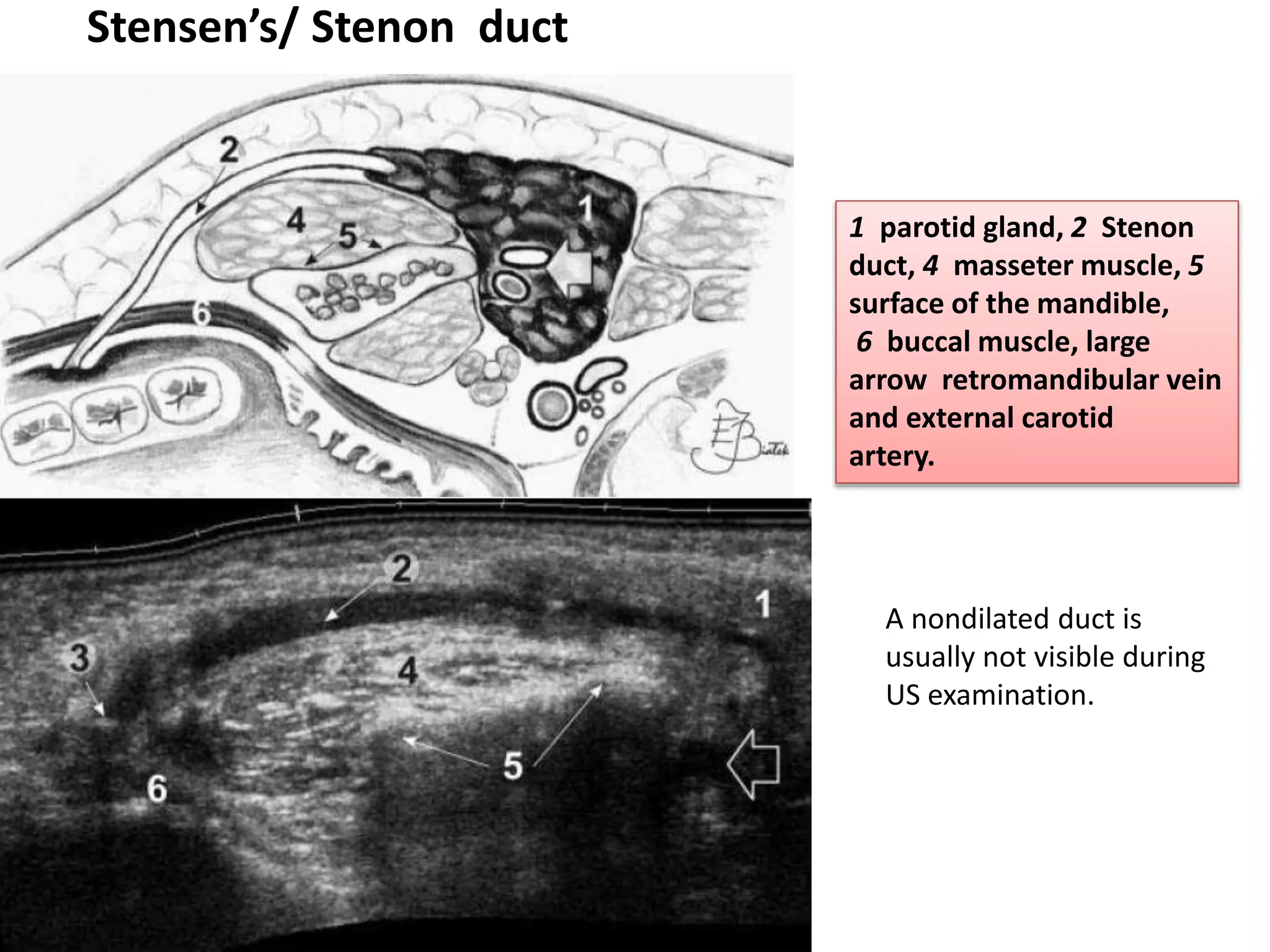 Imaging of salivary gland lesion | PPTX