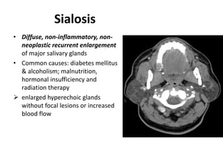 Imaging of salivary gland lesion | PPTX