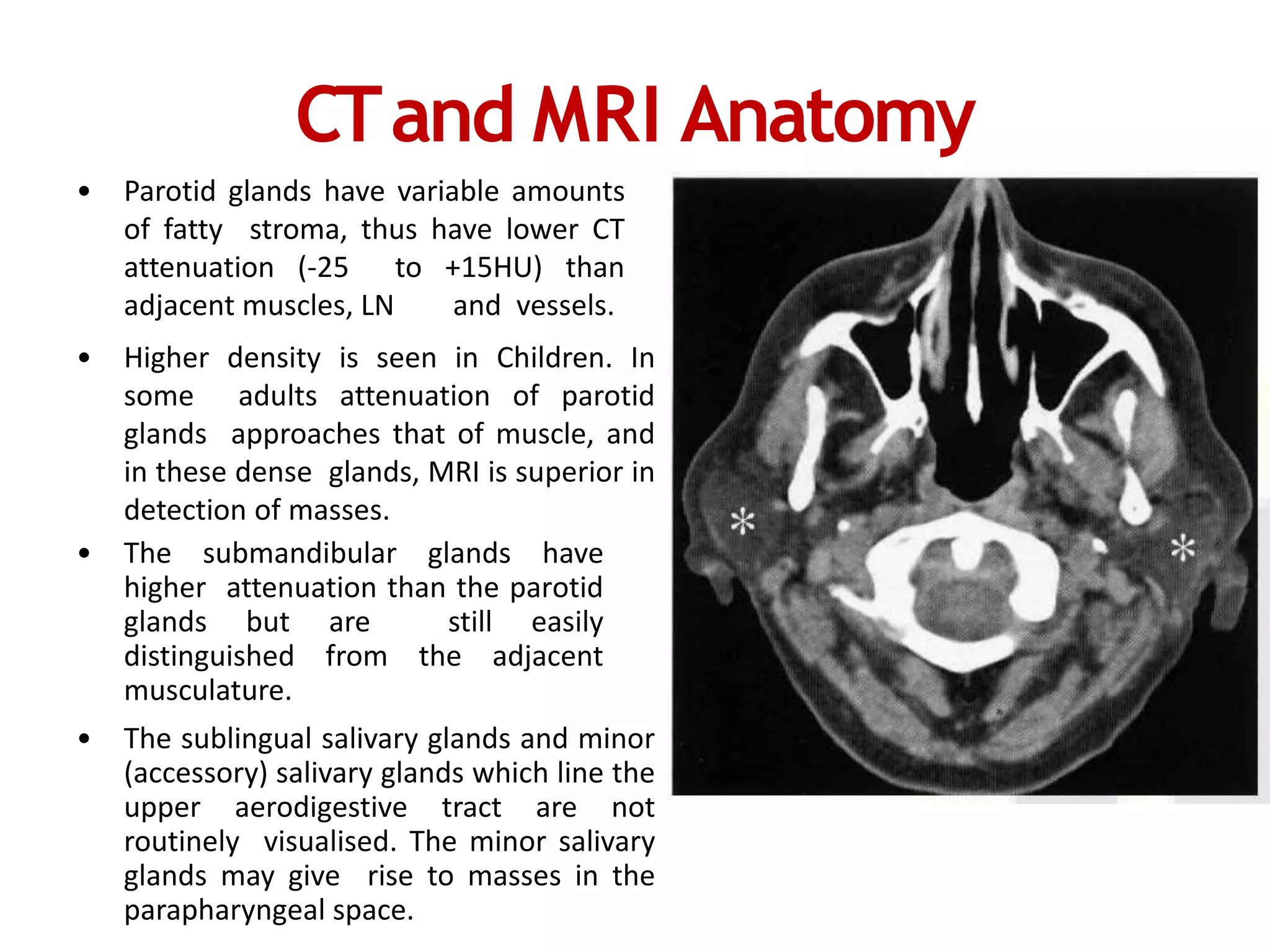 Imaging of salivary glands | PPTX