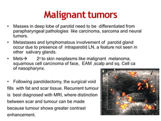 Imaging of salivary glands | PPTX