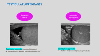 imaging of scrotum [Repaired] [Repaired].pptx