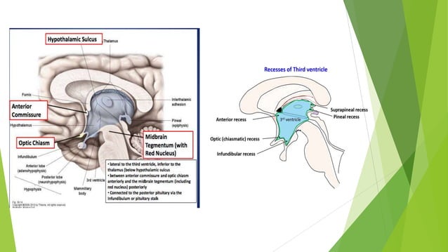 IMAGING OF SELLA AND SELLAR LESIONS MONICA.pptx | Endocrine and ...