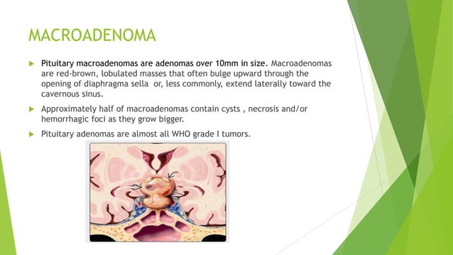 IMAGING OF SELLA AND SELLAR LESIONS MONICA.pptx | Endocrine and ...