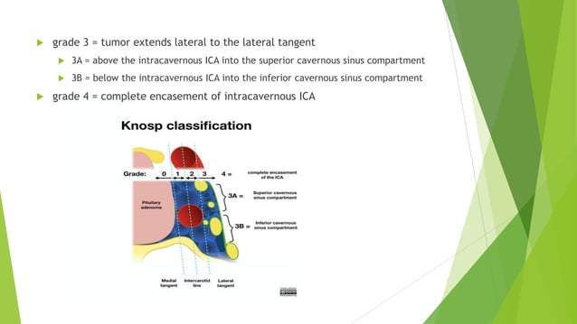 IMAGING OF SELLA AND SELLAR LESIONS MONICA.pptx | Endocrine and ...