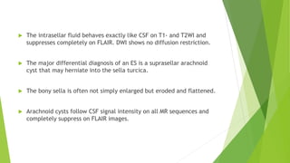 IMAGING OF SELLA AND SELLAR LESIONS MONICA.pptx