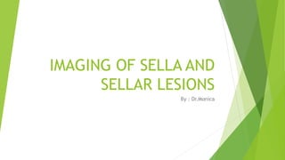 IMAGING OF SELLA AND SELLAR LESIONS MONICA.pptx