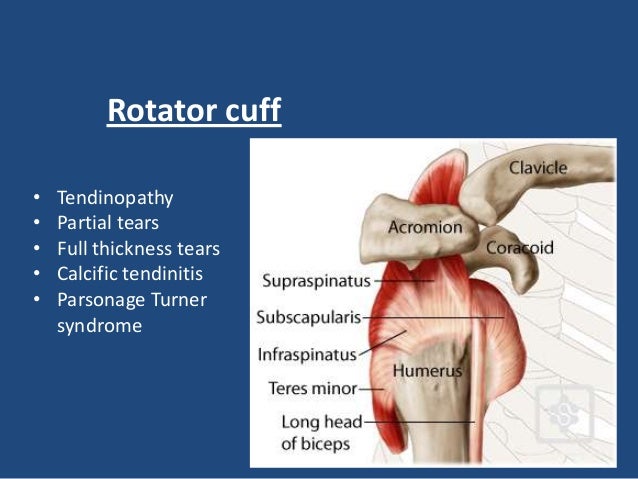Imaging of shoulder - Dr. Vishal Sankpal