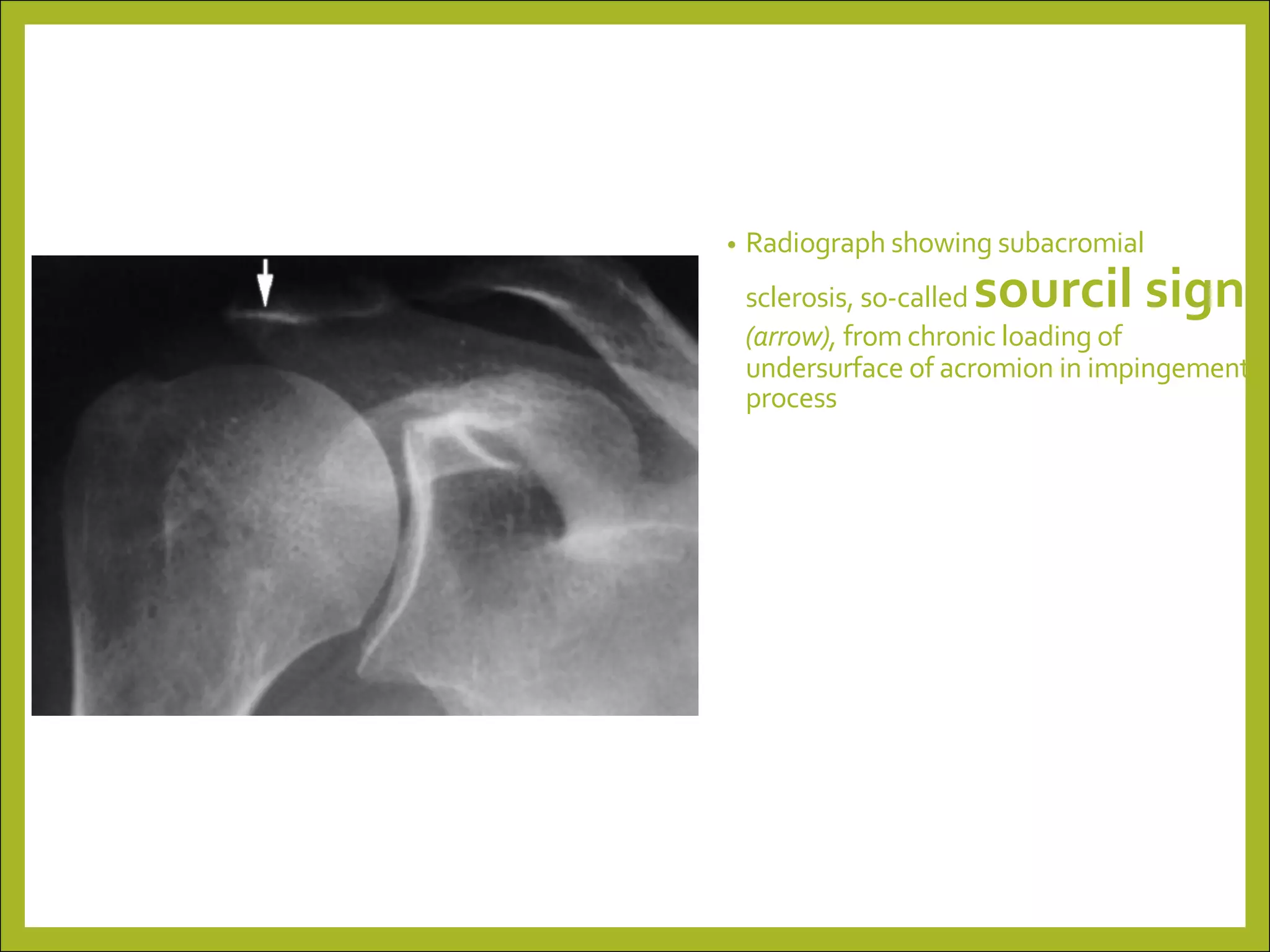 Radiological Examination of Shoulder and Elbow | PDF