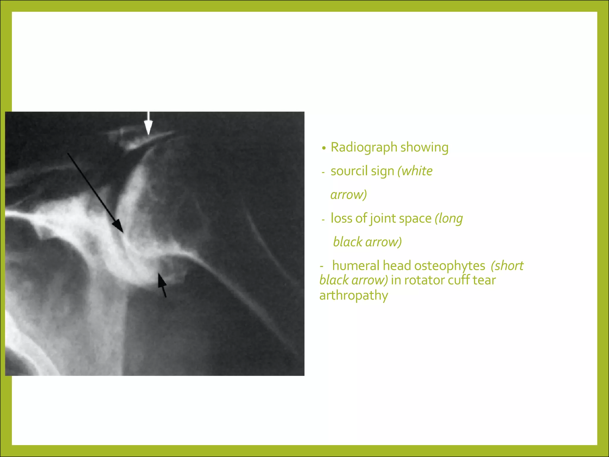 Radiological Examination of Shoulder and Elbow | PDF