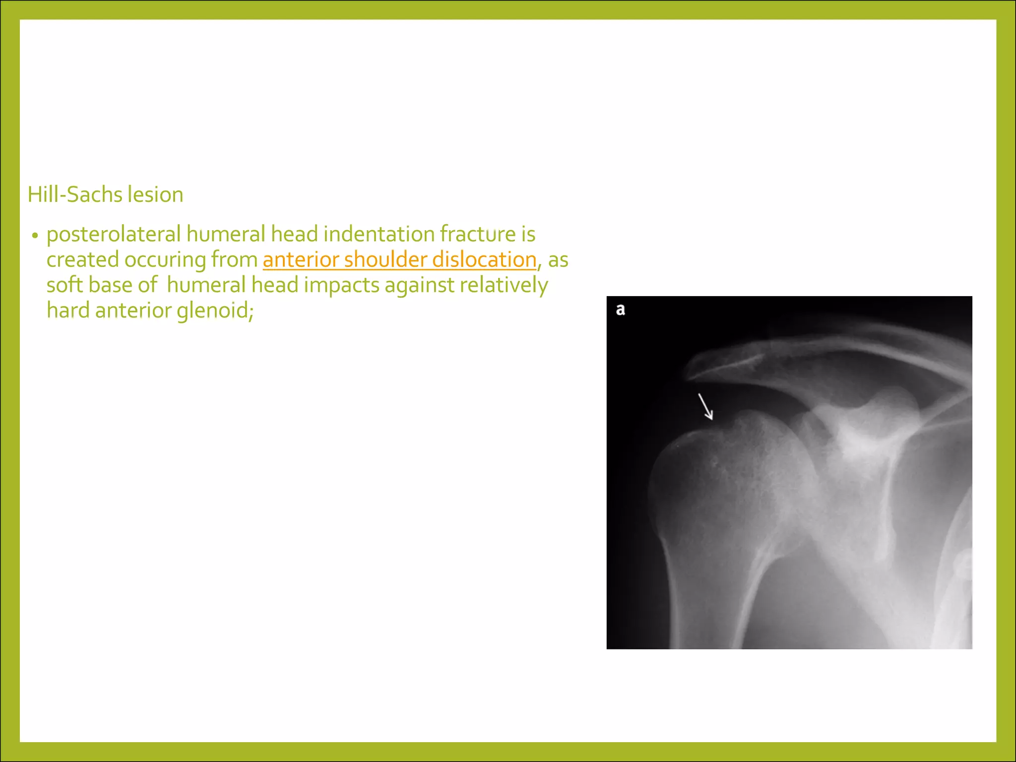 Radiological Examination of Shoulder and Elbow | PDF
