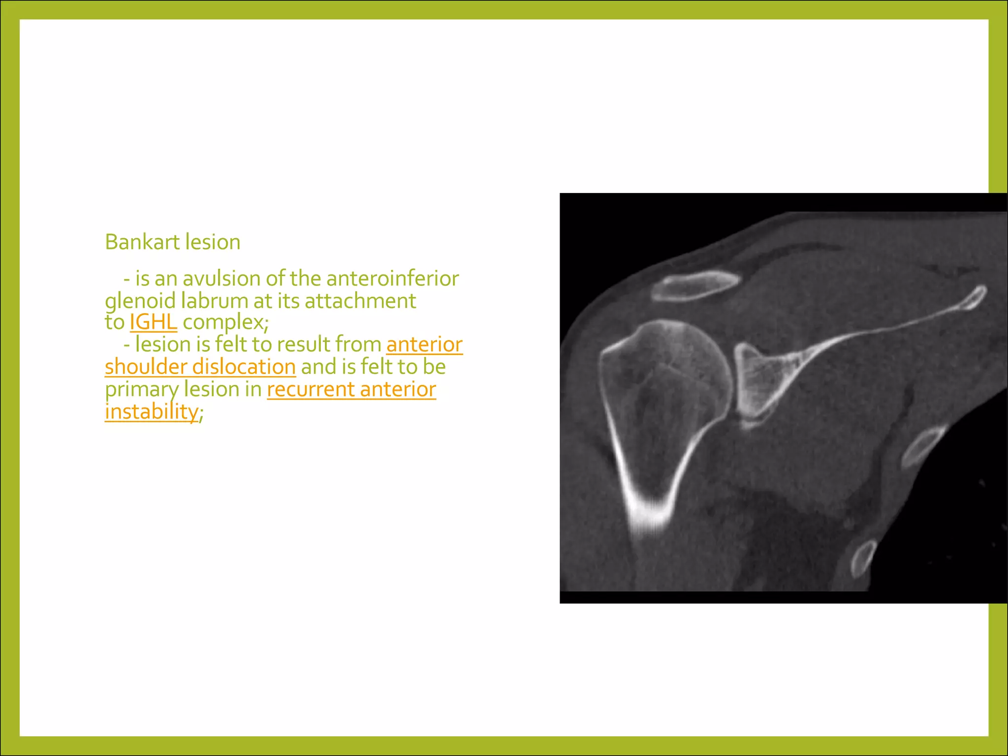 Radiological Examination of Shoulder and Elbow | PDF