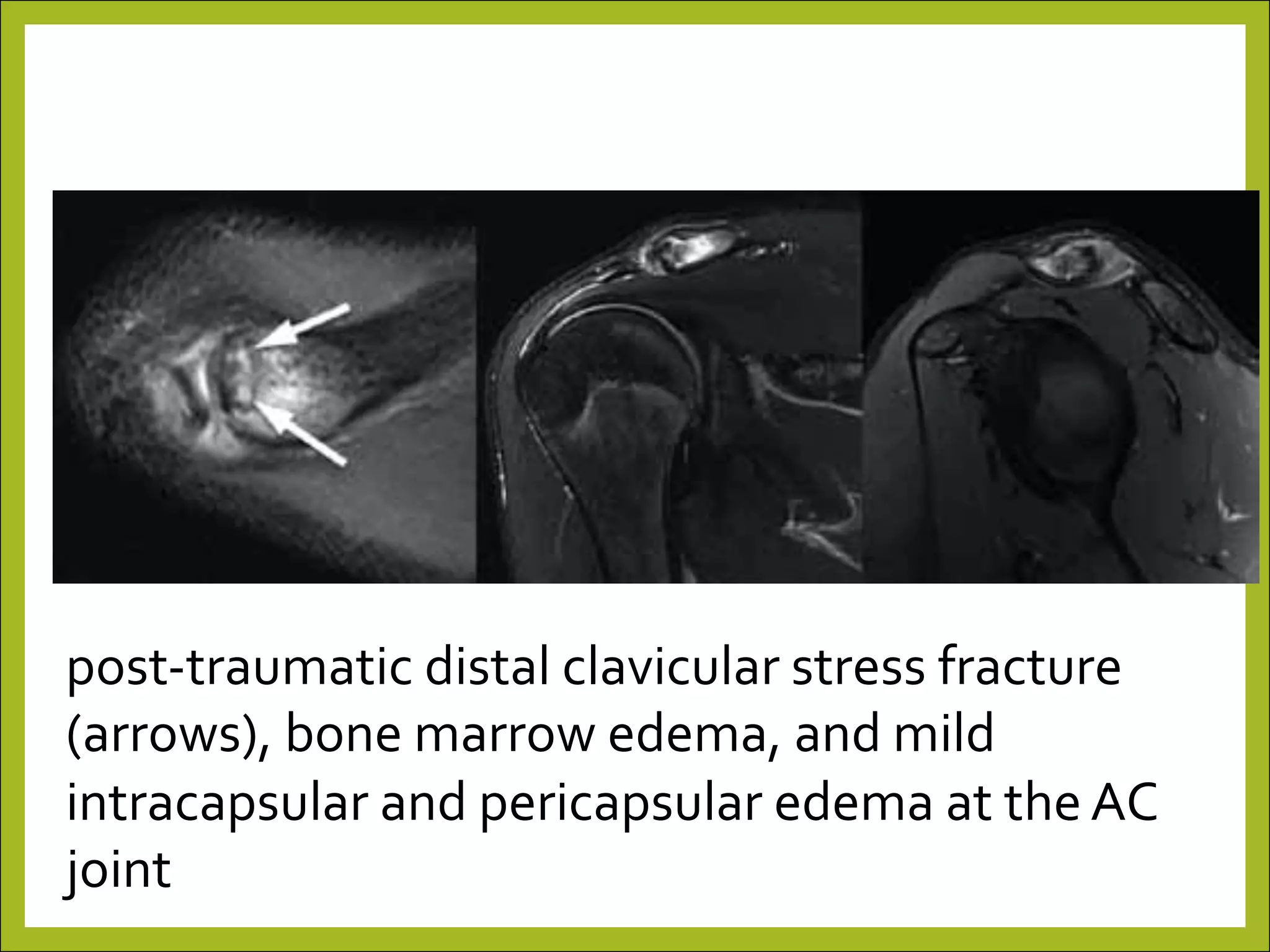 Radiological Examination of Shoulder and Elbow | PDF