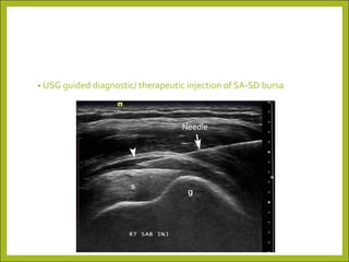 Radiological Examination of Shoulder and Elbow | PDF