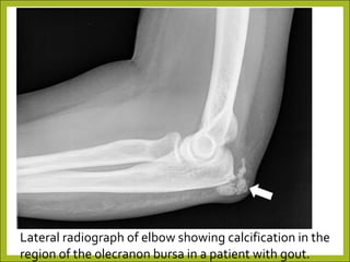 Radiological Examination of Shoulder and Elbow | PDF