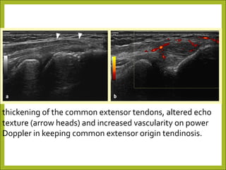 Radiological Examination of Shoulder and Elbow | PDF