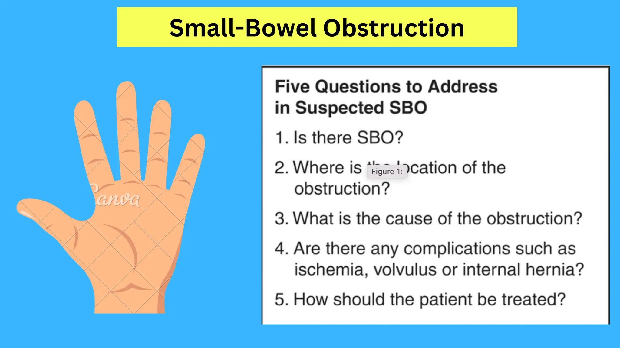 Radiological Imaging of Small-Bowel Obstruction | PDF