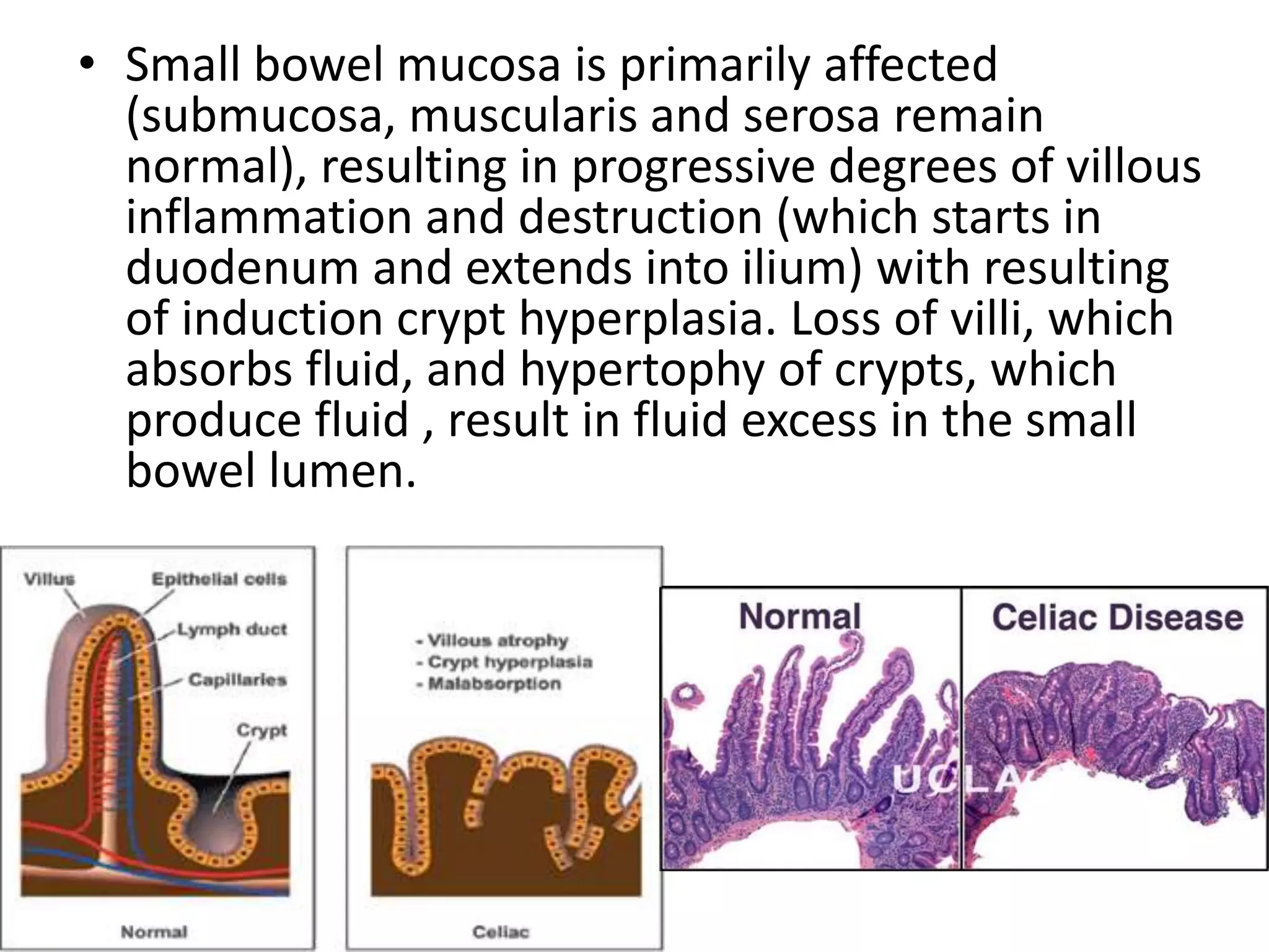 Imaging of small bowel pathology | PPTX