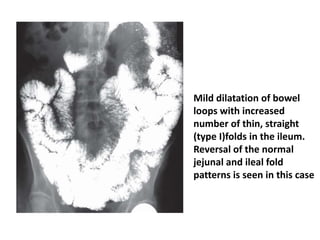 Imaging of small bowel pathology | PPTX