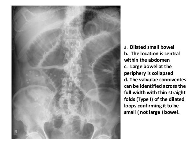 Imaging of small bowel pathology