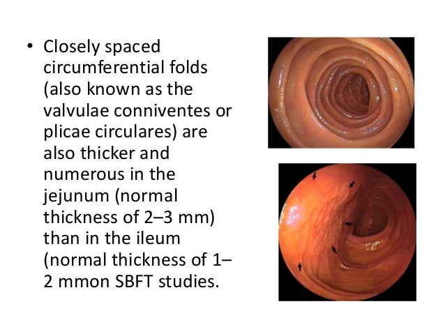 Imaging of small bowel pathology