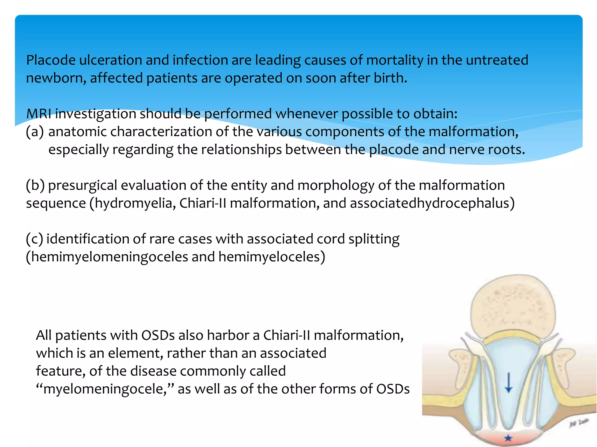 Imaging of spinal dysraphism | PPTX