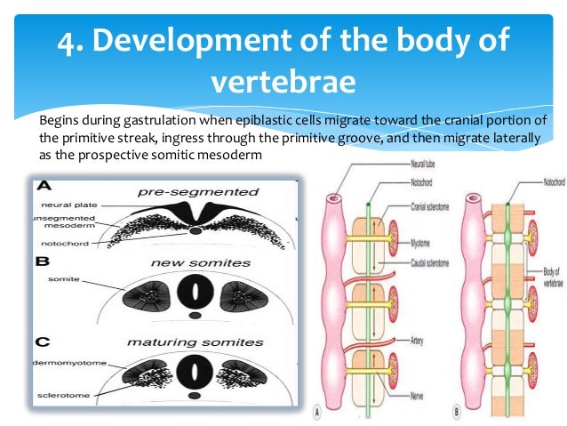 Imaging of spinal dysraphism