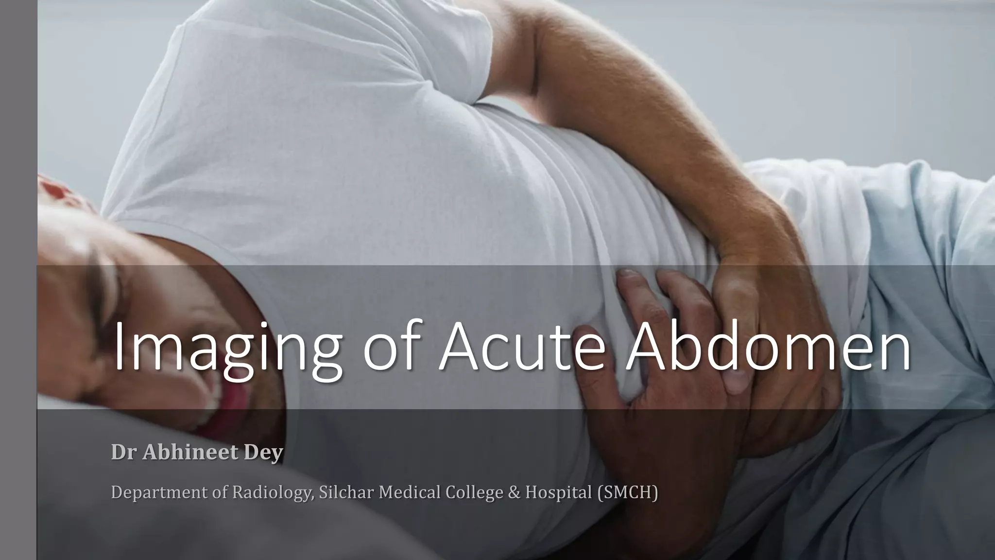 Imaging of Acute Abdomen | PPTX