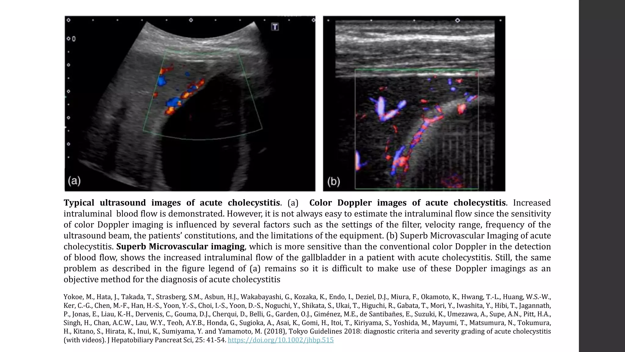 Imaging of Acute Abdomen | PPTX