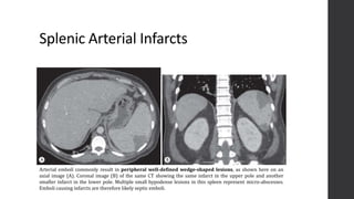 Imaging of Acute Abdomen | PPTX
