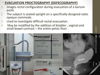 Imaging of the large bowel | PPT