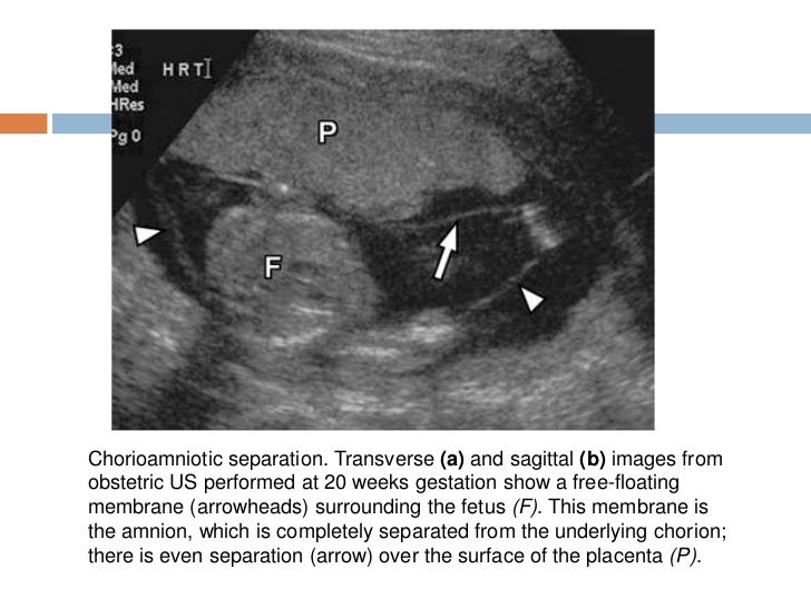 Imaging of the placenta