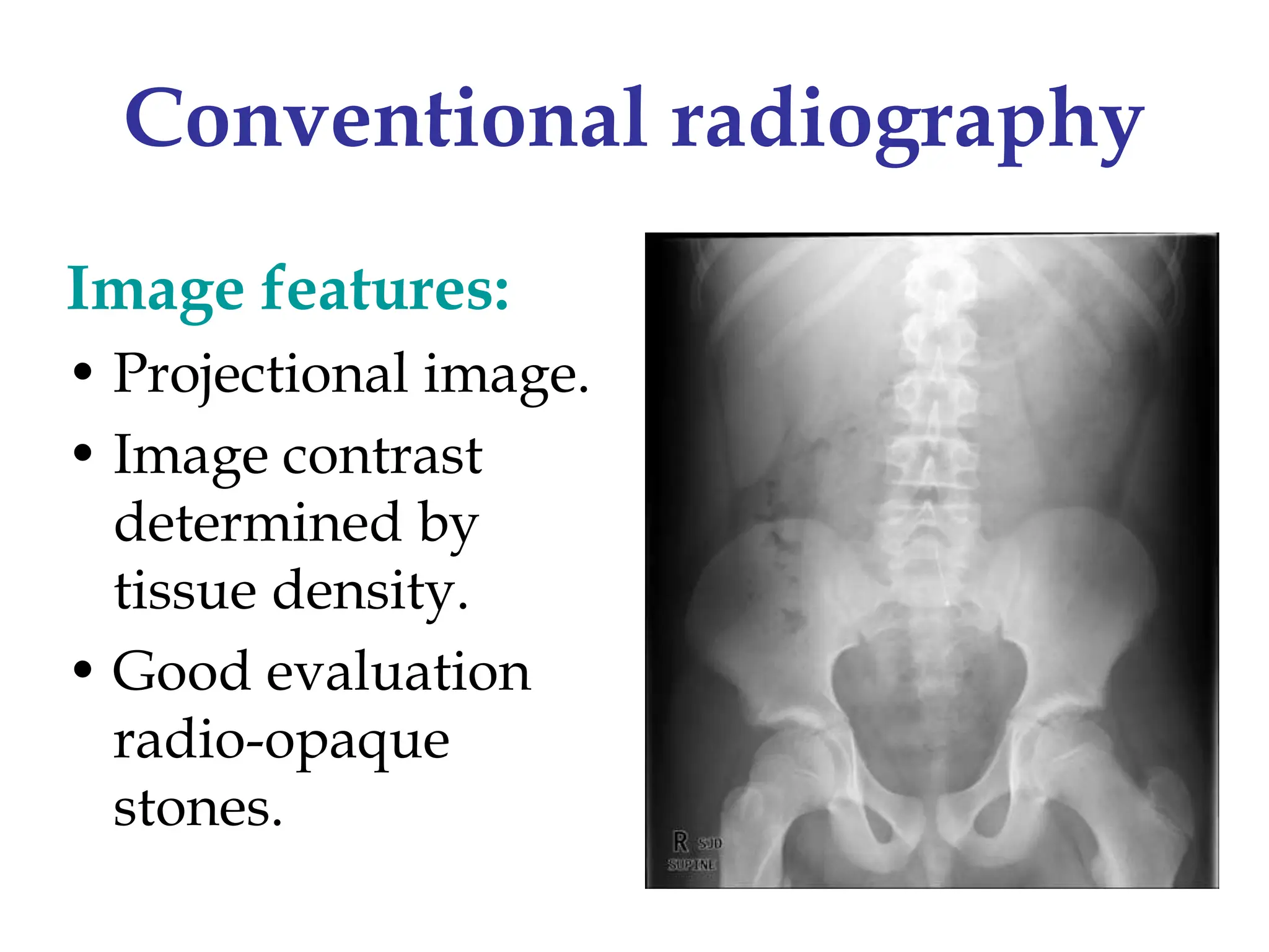 Imaging of the Renal System..........ppt