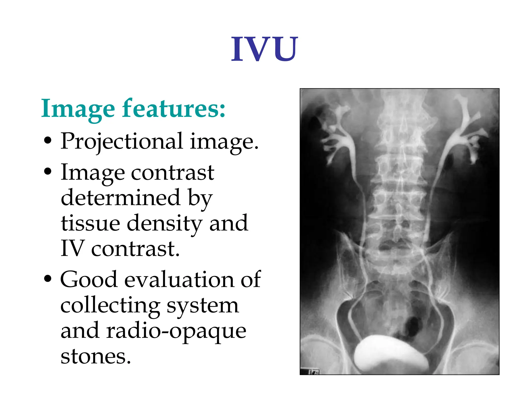 Imaging of the Renal System..........ppt