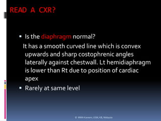 Imaging of the respiratory system -EduPublish-www.slidesharenet-mma ...