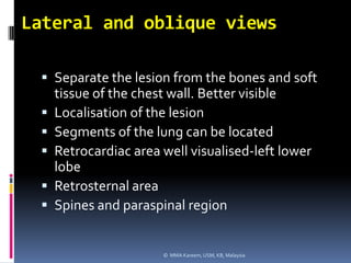 Imaging of the respiratory system -EduPublish-www.slidesharenet-mma ...