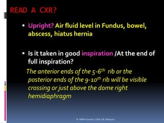 Imaging of the respiratory system -EduPublish-www.slidesharenet-mma ...