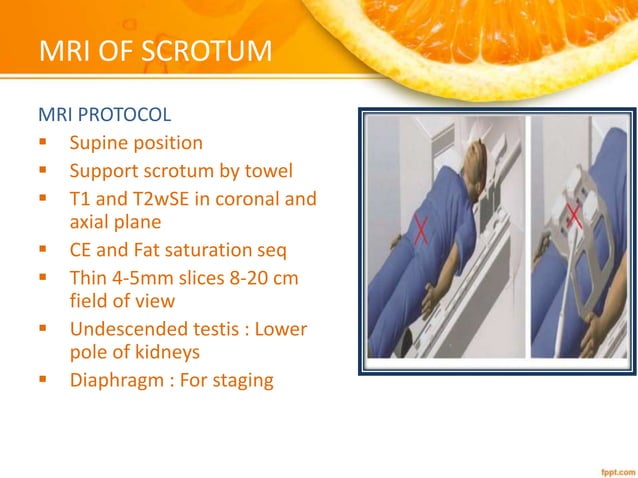 Imaging of the scrotum | PPTX