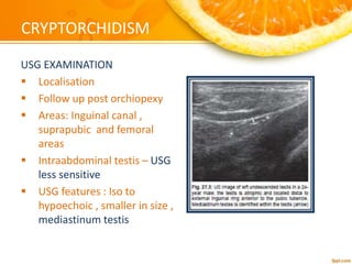 Imaging of the scrotum | PPTX