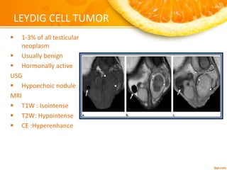 Imaging of the scrotum | PPTX