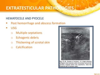 Imaging of the scrotum | PPTX