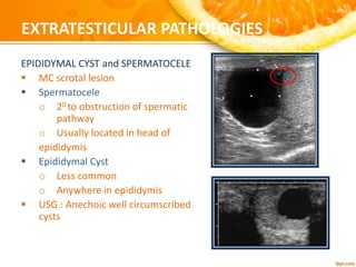 Imaging of the scrotum | PPTX